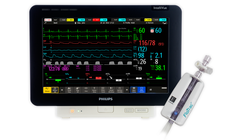 Philips Flotrac | Edwards Lifesciences
