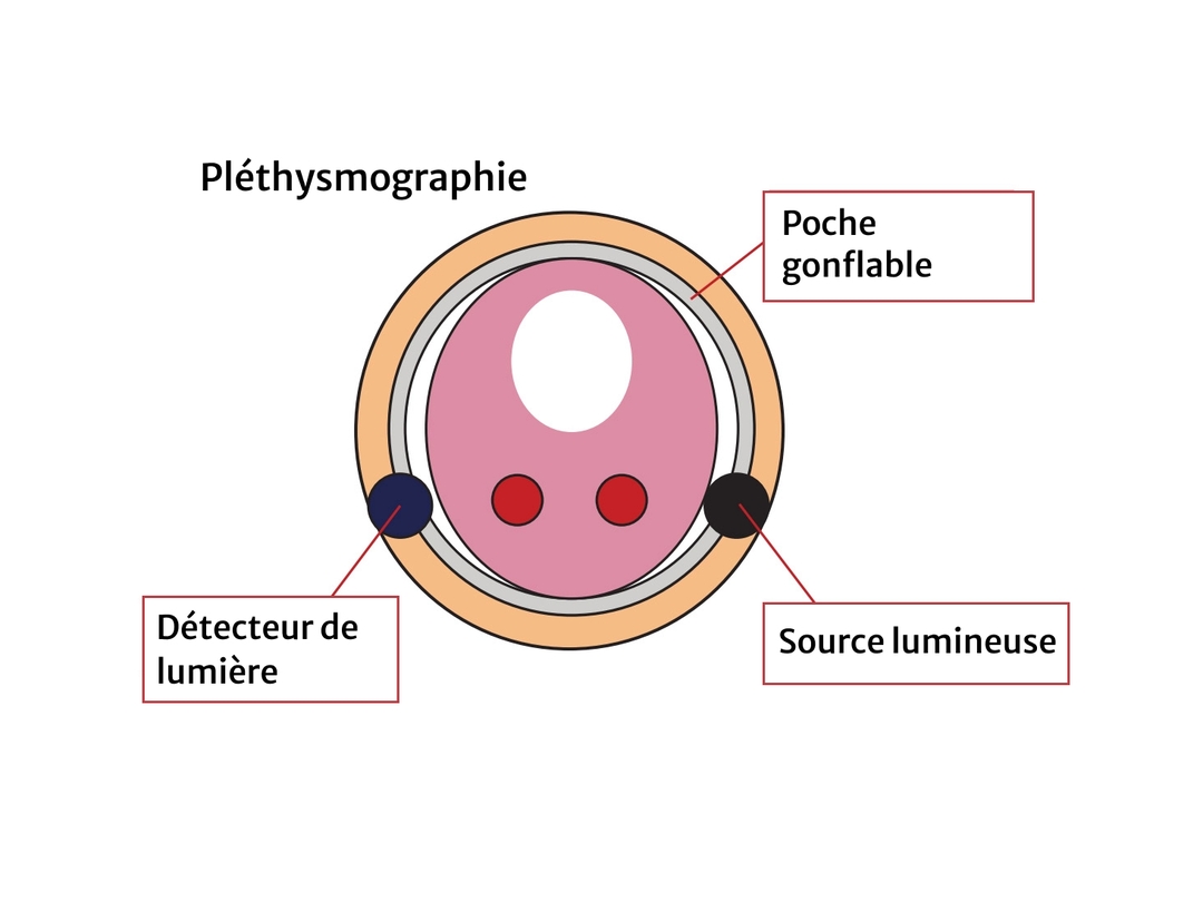 Système ClearSight | Edwards Lifesciences