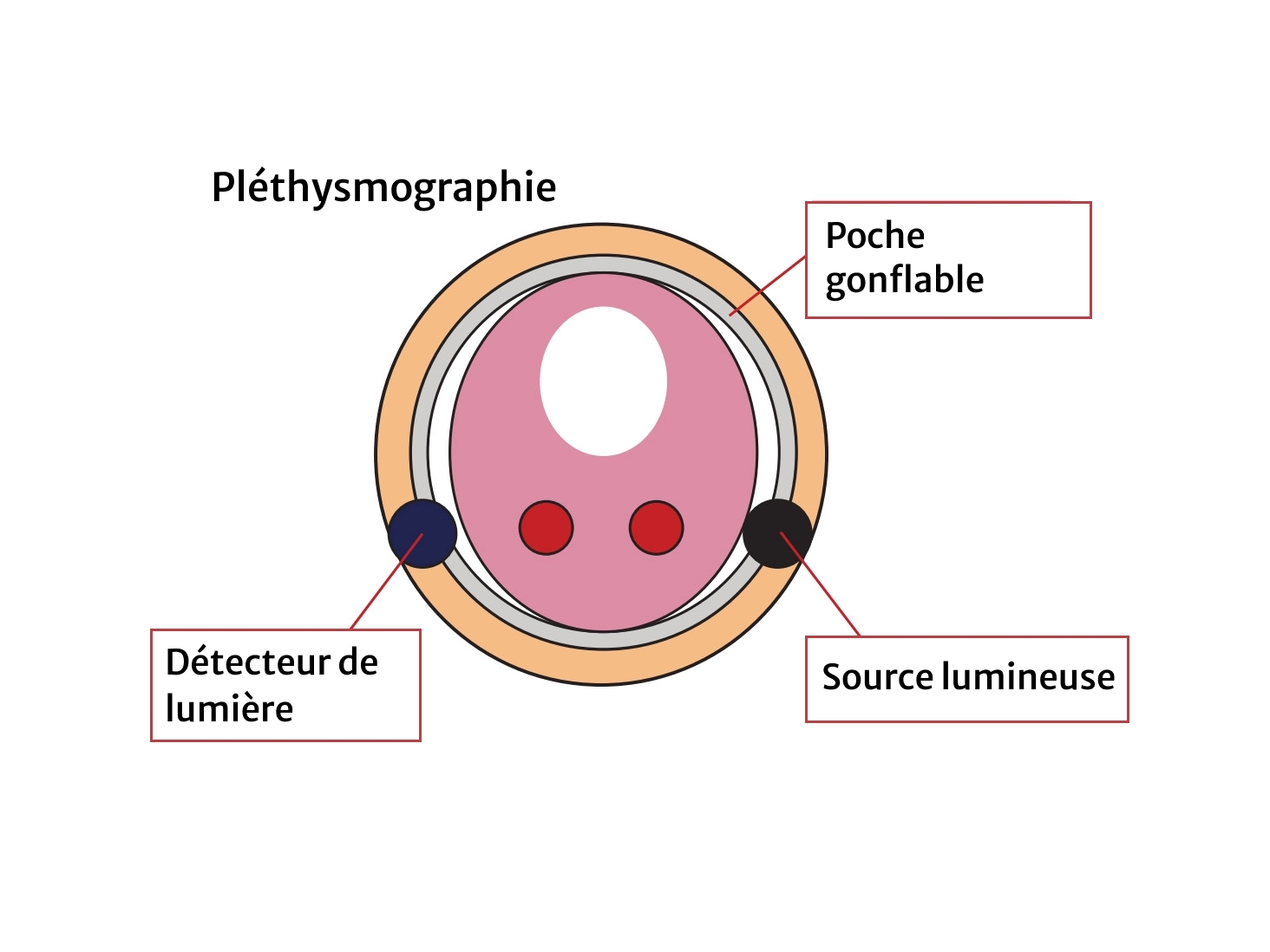 Système ClearSight | Edwards Lifesciences