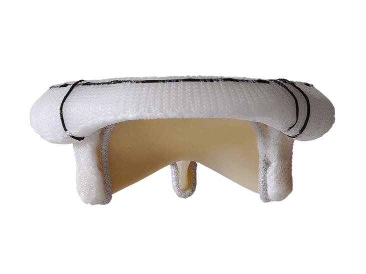 Mitral Pericardial Valve | Edwards Lifesciences