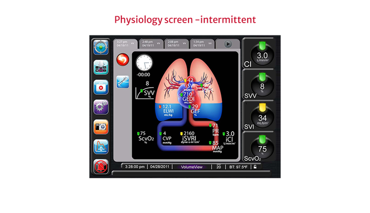 VolumeView System | Edwards Lifesciences