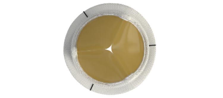 Valves options | Edwards Lifesciences