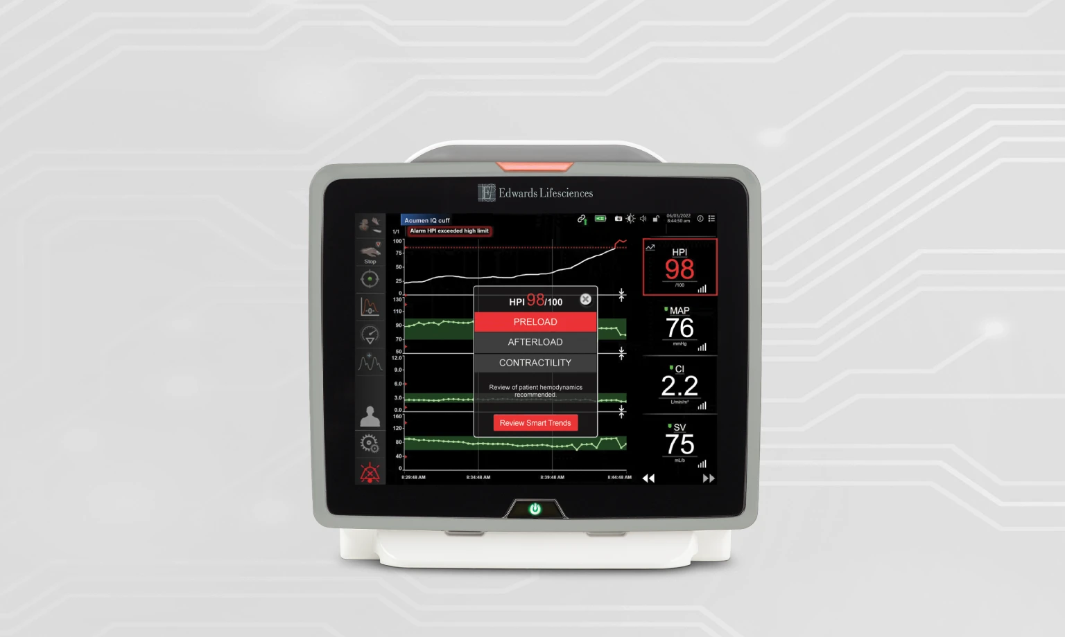 Clinical Evidence Acumen Hypotension Prediction Index Hpi Software Edwards Lifesciences