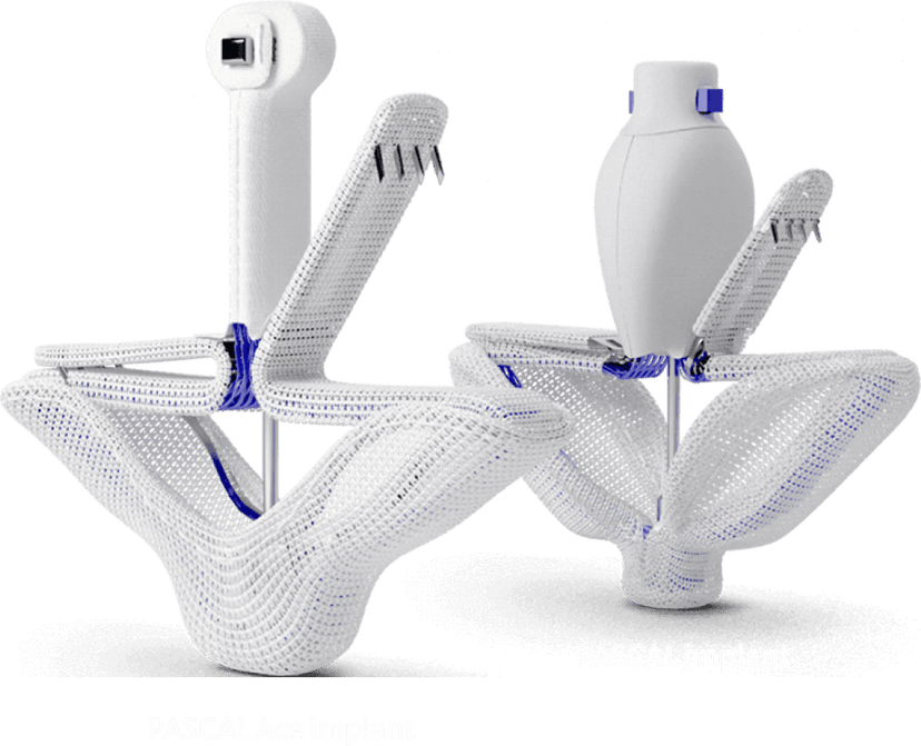 About the PASCAL implant | Edwards Lifesciences