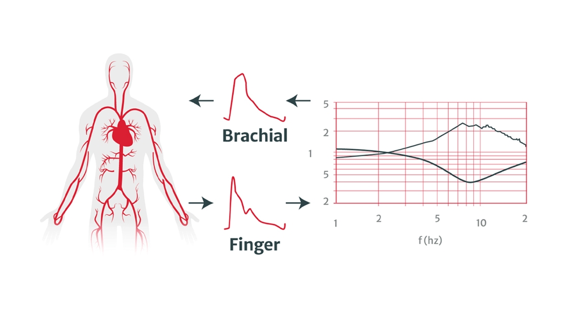Acumen IQ cuff | Edwards Lifesciences