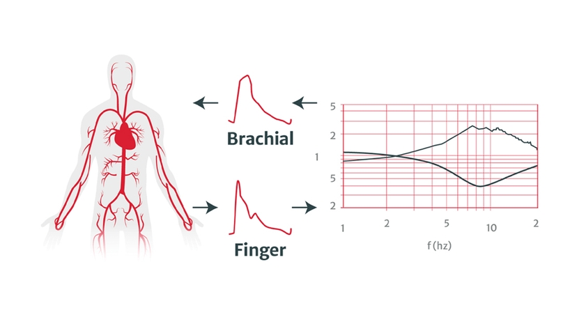 Acumen IQ cuff | Edwards Lifesciences
