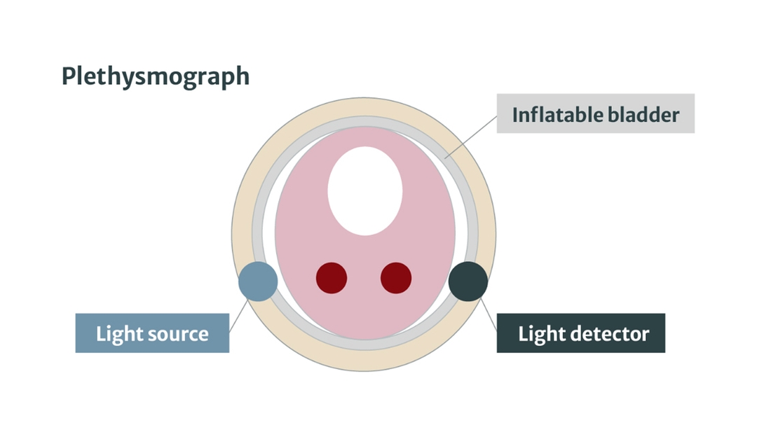 Acumen IQ cuff | Edwards Lifesciences
