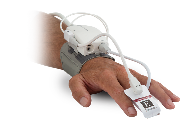 Acumen Assisted Fluid Management software | Edwards Lifesciences