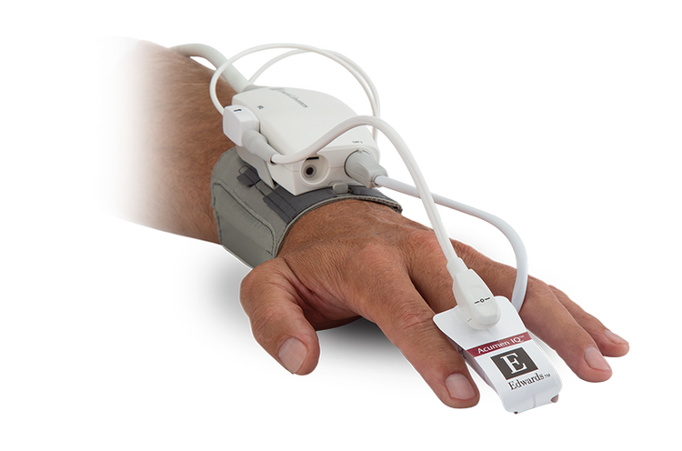 Acumen Assisted Fluid Management software | Edwards Lifesciences