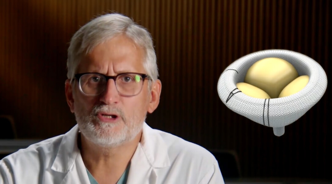 MITRIS RESILIA resources | Edwards Lifesciences