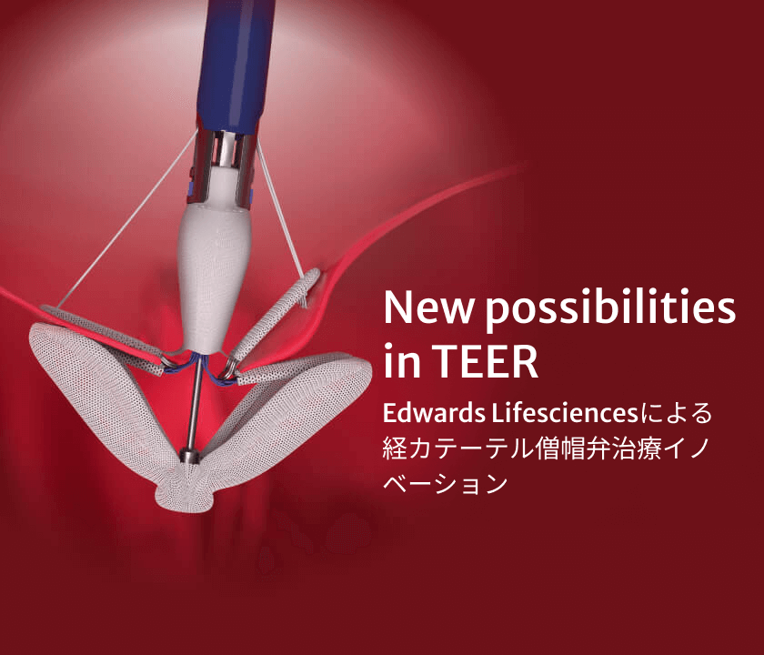 PASCAL Precision システム | Edwards Lifesciences