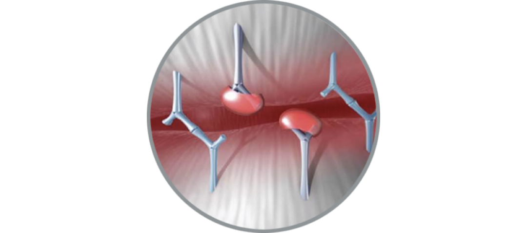 RESILIA tissue | Edwards Lifesciences