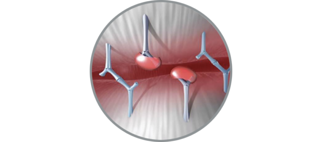 RESILIA tissue | Edwards Lifesciences