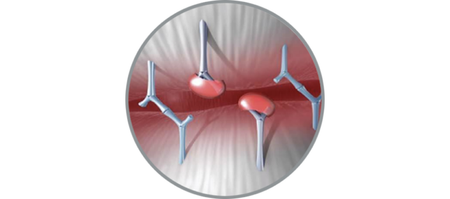 RESILIA tissue | Edwards Lifesciences