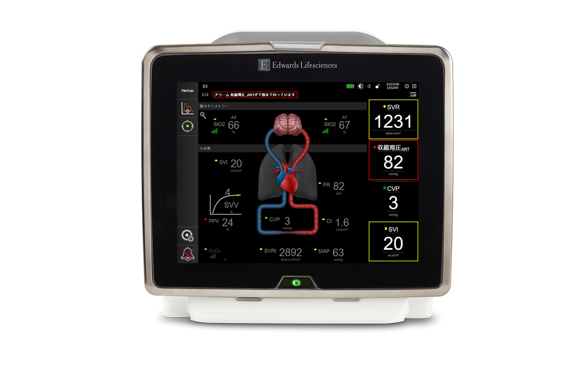 ForeSight センサ | Edwards Lifesciences
