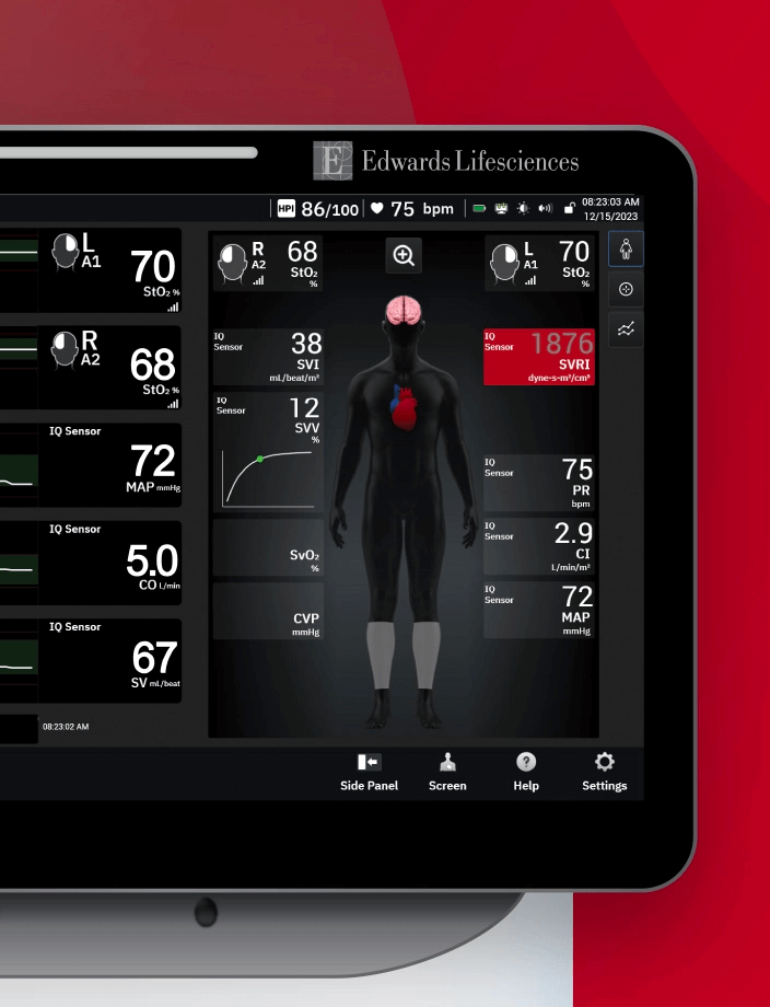 HemoSphere Alta monitor | Edwards Lifesciences