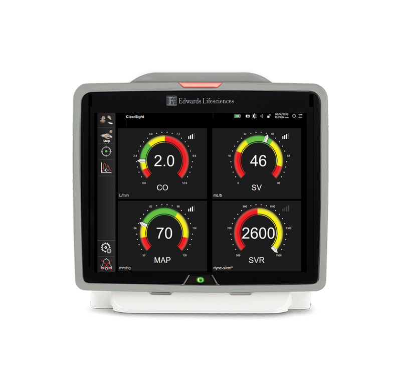 Acumen Hypotension Prediction Index software | Edwards Lifesciences