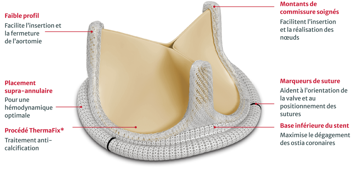 Valves aortiques péricardiques chirurgicales | Edwards Lifesciences