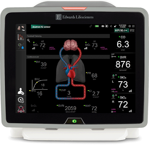 ForeSight tissue oximetry sensor | Edwards Lifesciences