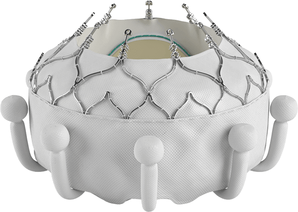 TRISCEND II Trial for Tricuspid Regurgitation | Edwards Lifesciences