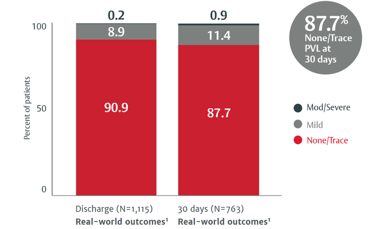 Transcatheter SAPIEN 3 Ultra | Edwards Lifesciences