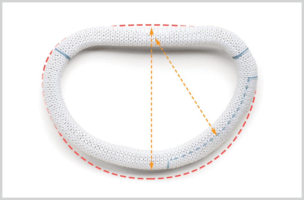 Mitral Valve Repair | Edwards Lifesciences