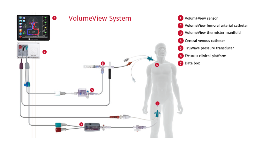 VolumeView System | Edwards Lifesciences
