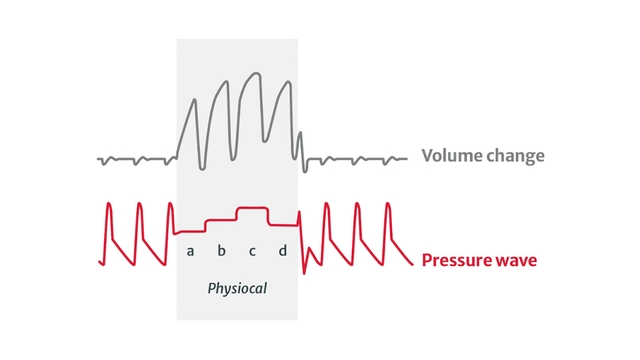 Acumen IQ cuff | Edwards Lifesciences