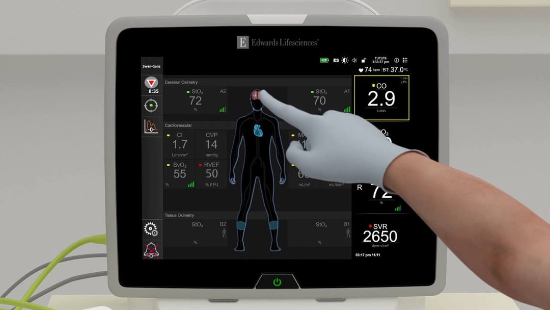 HemoSphere setup 2 | Edwards Lifesciences