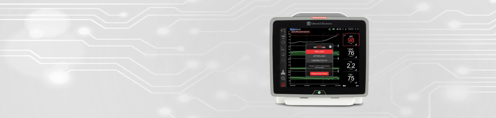Clinical Evidence Acumen Hypotension Prediction Index Hpi Software Edwards Lifesciences