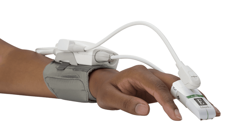 Acumen IQ sensor | Edwards Lifesciences