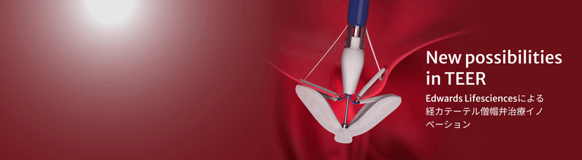 PASCAL Precision システム | Edwards Lifesciences