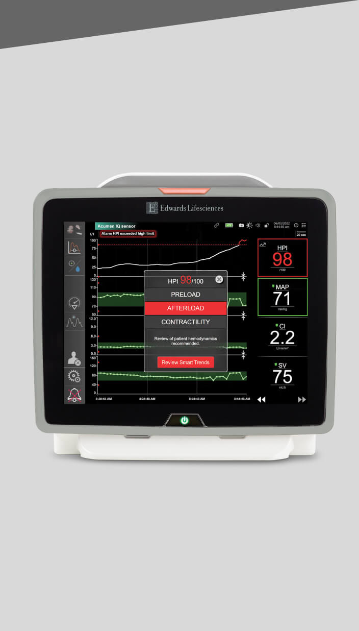 Clinical Evidence Acumen Hypotension Prediction Index Hpi Software Edwards Lifesciences