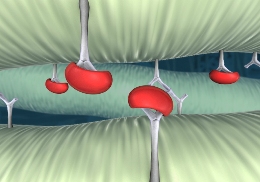 Surgical structural heart therapies | Edwards Lifesciences