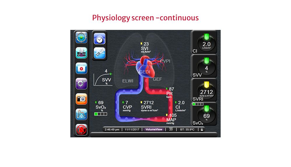 VolumeView System | Edwards Lifesciences