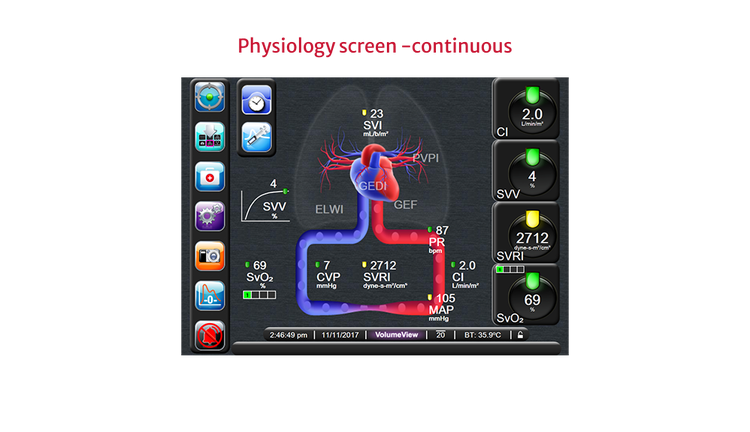 VolumeView System | Edwards Lifesciences