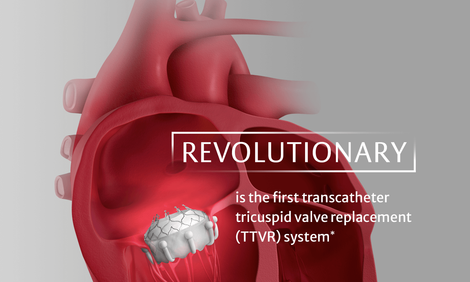 EVOQUE Tricuspid Valve Replacement | Edwards Lifesciences
