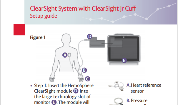 ClearSight Jr finger cuff | Edwards Lifesciences