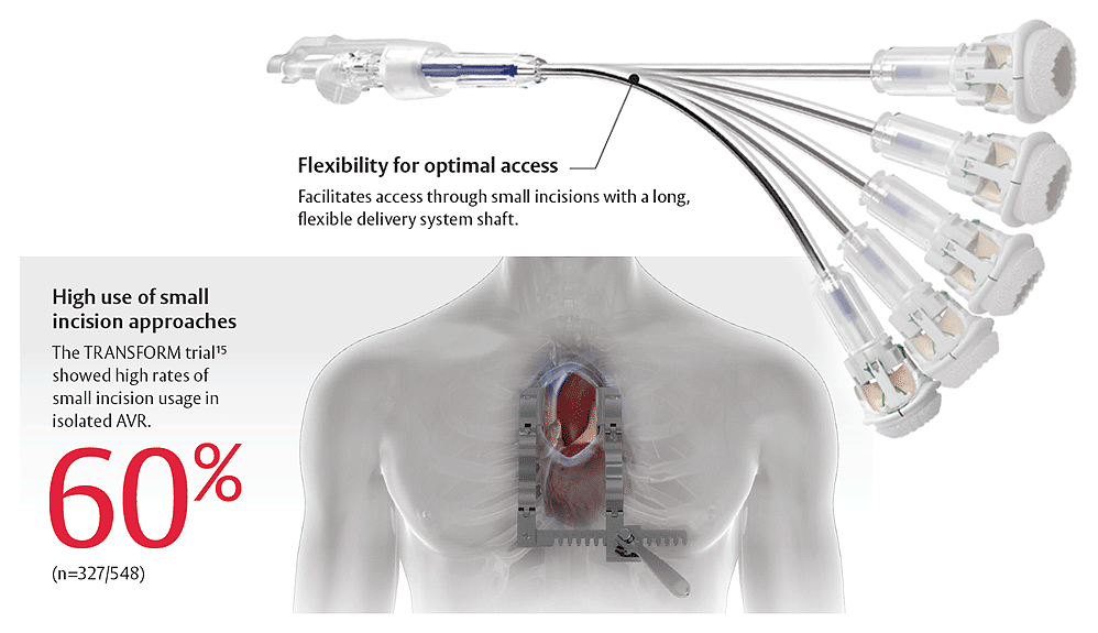 Edwards Intuity Elite valve system | Edwards Lifesciences