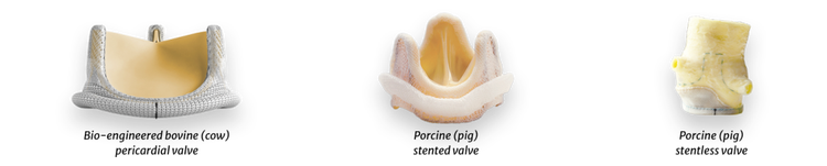 Valves options | Edwards Lifesciences