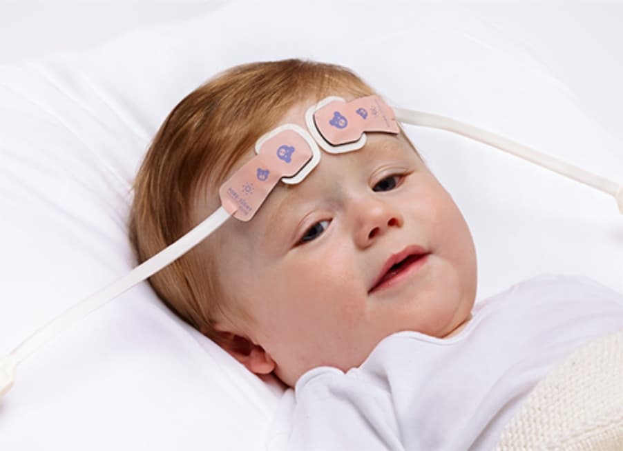 ForeSight Jr sensor | Edwards Lifesciences