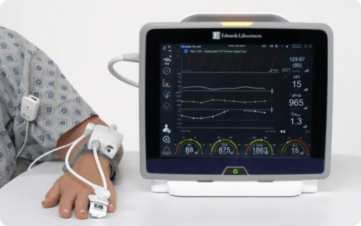 Acumen IQ cuff | Edwards Lifesciences