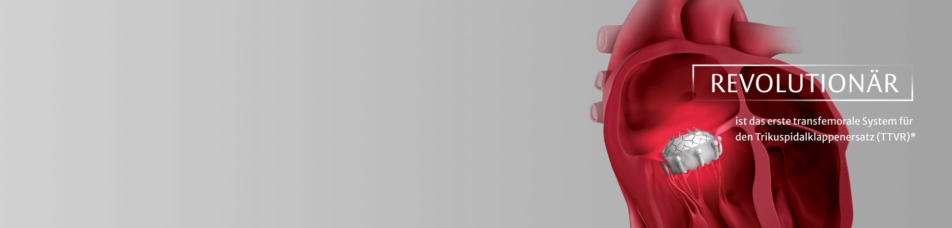 EVOQUE Trikuspidalklappenersatz | Edwards Lifesciences