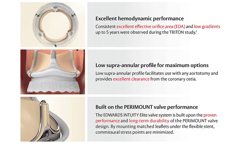 Edwards Intuity Elite valve system | Edwards Lifesciences
