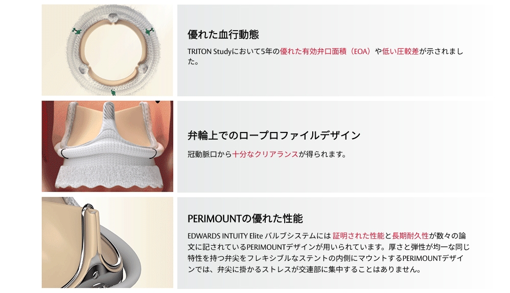 EDWARDS INTUITY Elite バルブシステム | Edwards Lifesciences