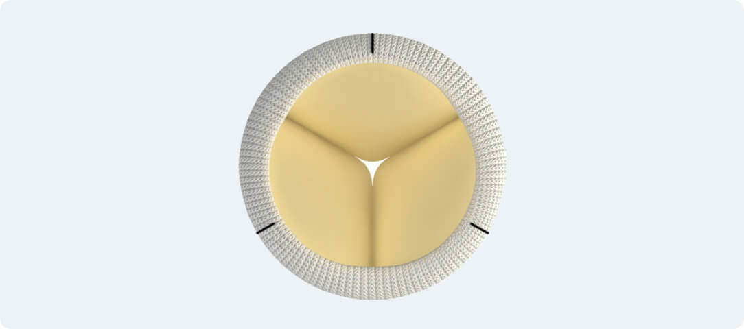 Comparing surgical valves | Edwards Lifesciences