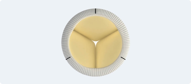 Comparing surgical valves | Edwards Lifesciences