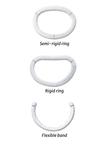Valves options | Edwards Lifesciences
