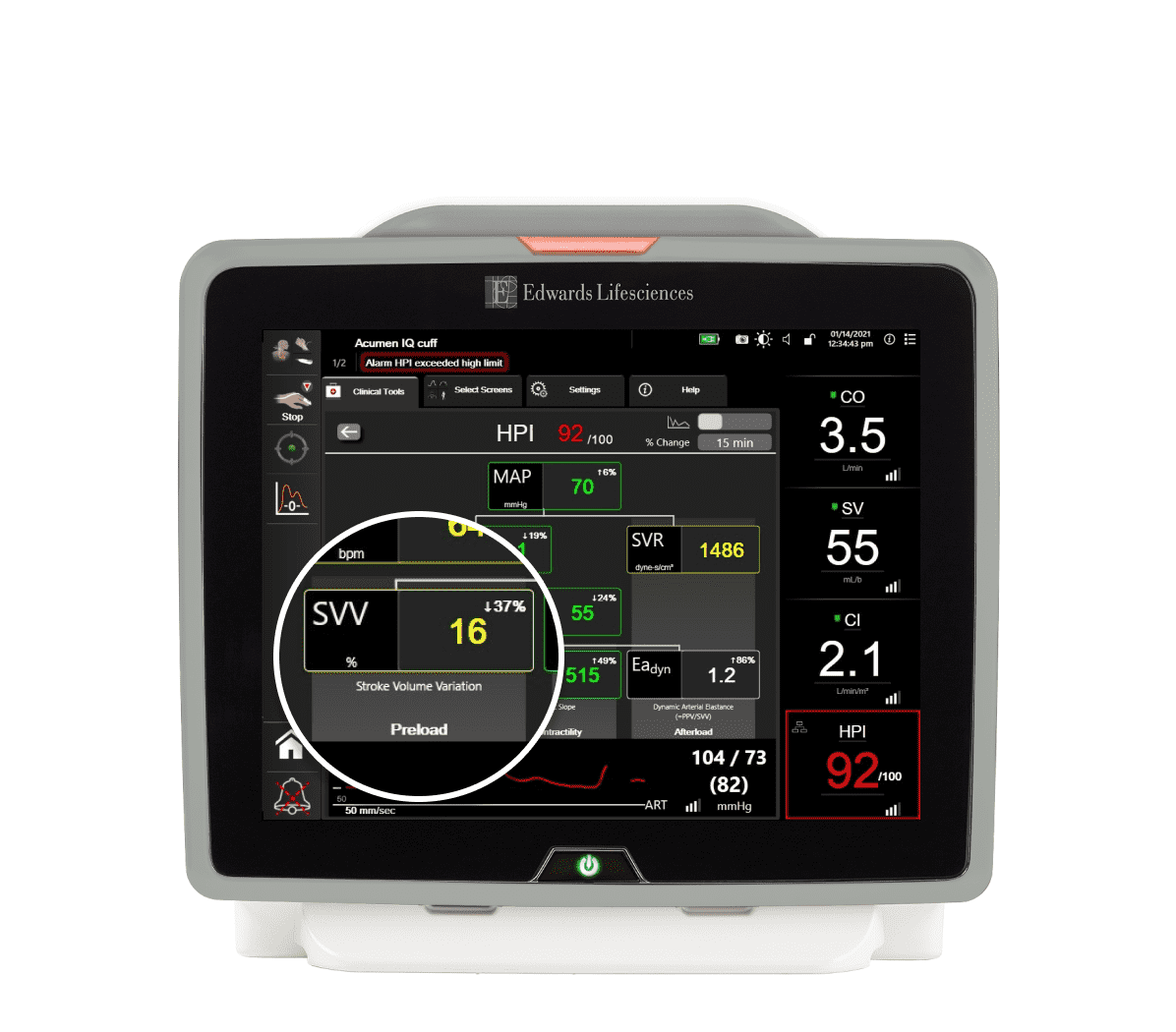 Acumen Hypotension Prediction Index software | Edwards Lifesciences