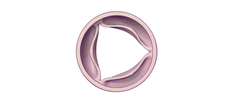 RESILIA aortic valve | Edwards Lifesciences